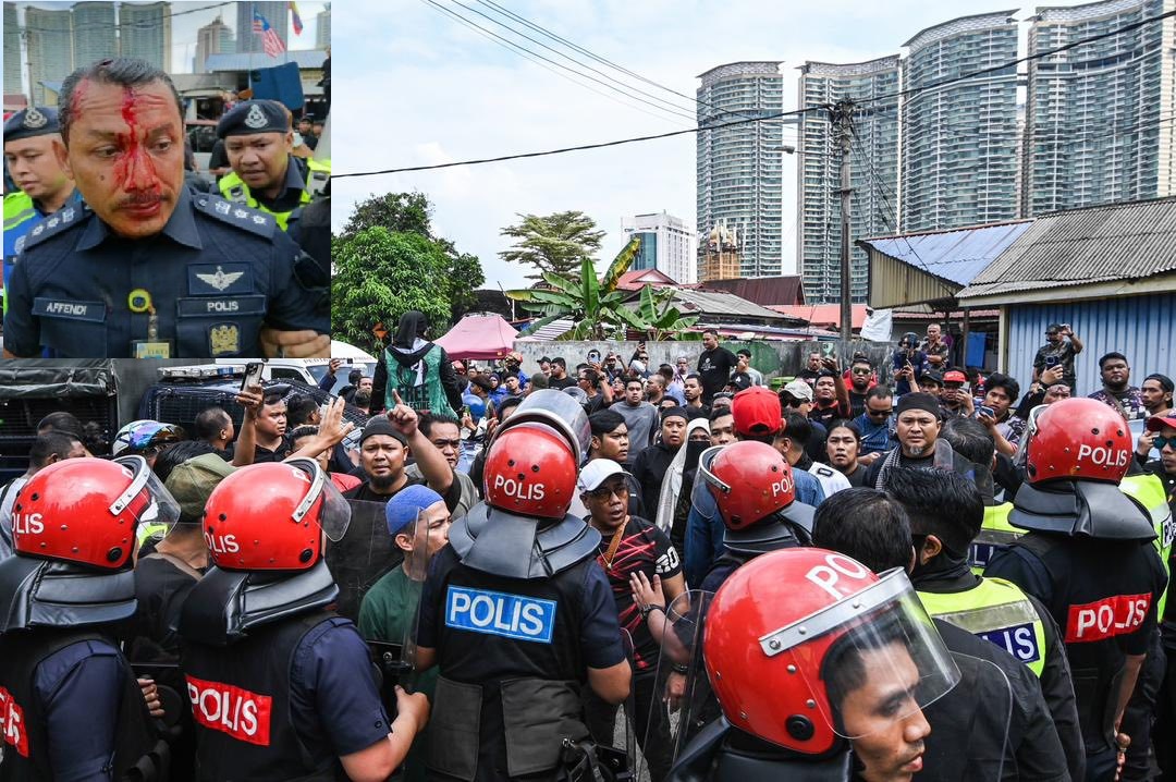 Yes, police chief injured in eviction-turned-bloody clash but what about fate of Kg Sg Baru ...