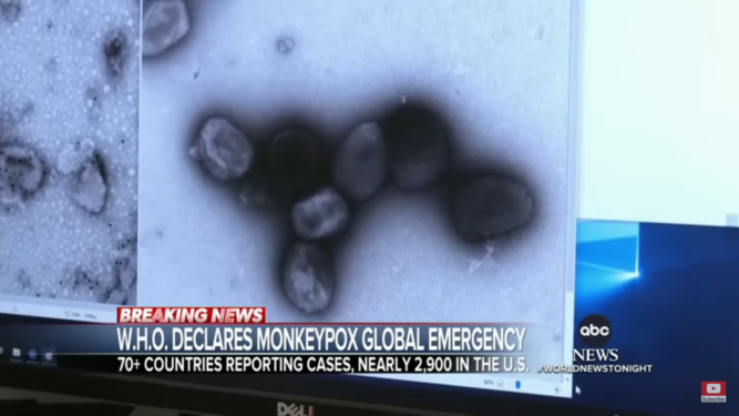 WHO declares monkeypox a global emergency - Focus Malaysia